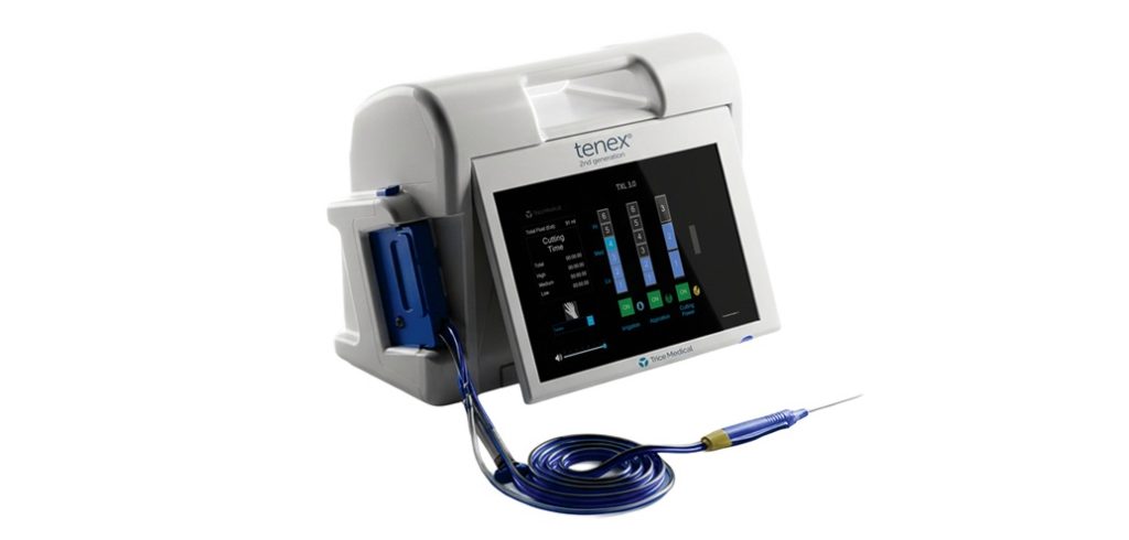 Trice Medical Launches Tenex® 2nd Generation Ultrasonic System ...