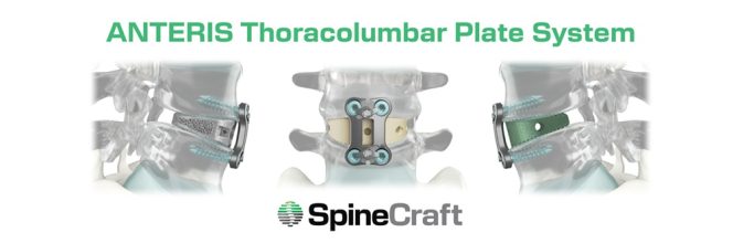 SpineCraft Announces U.S. FDA 510(k) Clearance of ANTERIS Thoracolumbar ...